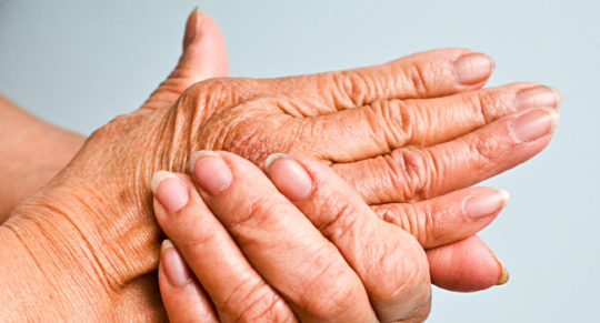 Rheumatoid Arthritis – AZIV Infusion Therapy Center